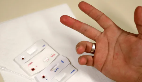 Global HIV Treatment Imperilled by Foriegn Aid cuts | The India Forum